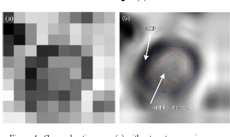figure 2 from bicubic interpolation and gradient based edge detection with skeletonization
