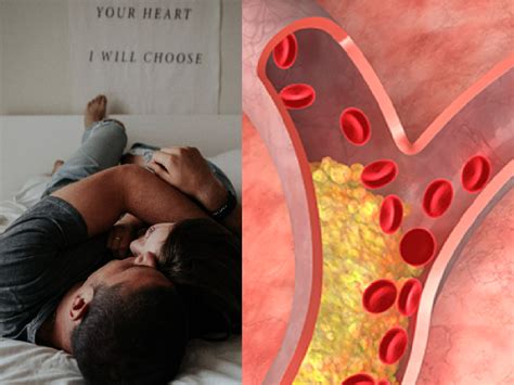High Cholesterol Pain During Sex Dont Ignore The Symptoms Of High