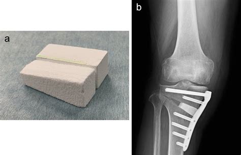Sptcp And Udptcp Wedges Were Formed To The Same Size Of The Opening Gap