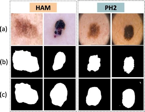 Figure 5 From Multi Task Explainable Skin Lesion Classification Semantic Scholar