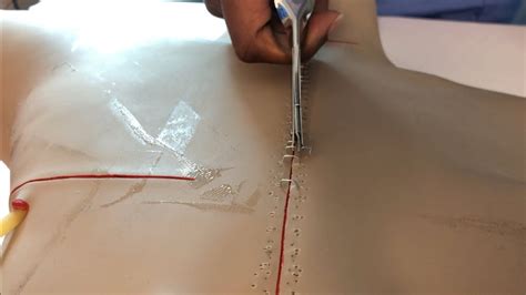 HOW TO REMOVE SURGICAL STAPLES SUTURES YouTube