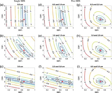 Influence Of Sourcedetector Separation On Diffuse Correlation Spectroscopy Measurements Of