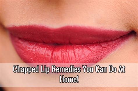 Chapped Lip Remedies You Can Do At Home Home Remedies