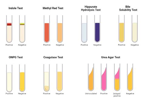 Microbiology Laboratory Tests Part BioRender Science Templates