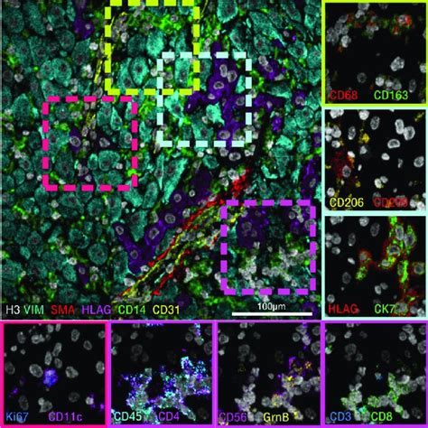 Light Microscopy Multiplex Chromogenic Immunohistochemistry Staining