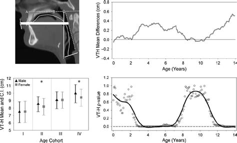 Vocal Tract Horizontal Vt H Upper Left Panel Midsagittal Ct Image Download Scientific