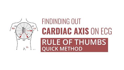 Ekg Cardiac Axis Rule Of Thumbs Youtube