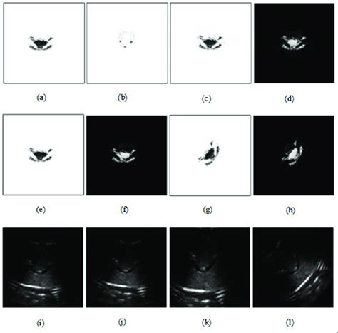Us Mri Registration Based On The Other Methods Without Mmbs A Us Download Scientific Diagram