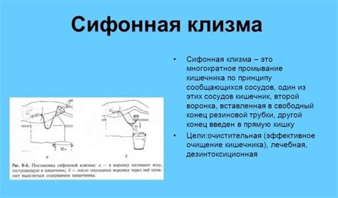 Сифонная клизма: алгоритм постановки и применяемые растворы