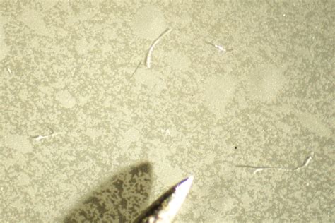 Microplastics Found In Human Blood Microplastic Survey