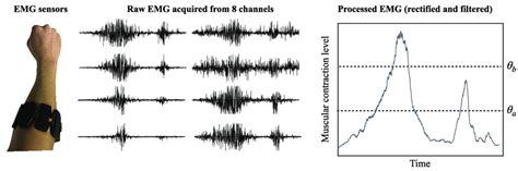 Sample Demonstrating The Processing Of Emg Signals Download