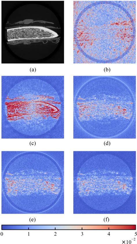 Figure 9 From Artifact Reduction For Sparse View Ct Using Deep Learning With Band Patch