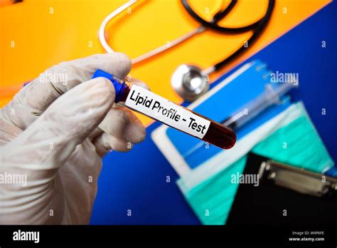 Lipid Profile Test With Blood Sample Top View Isolated On Color Background Healthcare