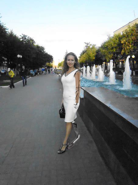 Ooe Amputee By Fluffy144 On Deviantart