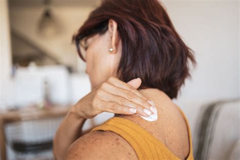 Actinic Keratosis Treatment Creams Freezing And More