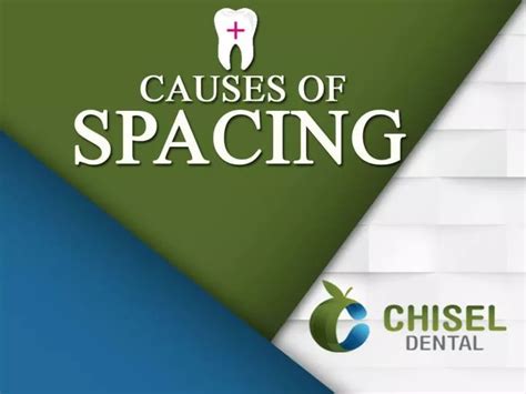 PPT Causes Of Spacing PowerPoint Presentation Free Download ID