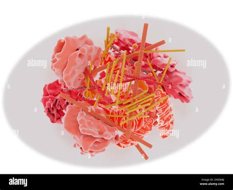 Molecular Structure Of A Lewy Body An Abnormal Aggregation Of Proteins