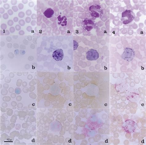 Reticulocyte Wright Stain