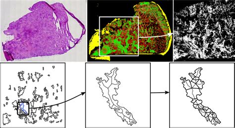 Polygon Decomposition In A Histopathological Tissue Sample Top