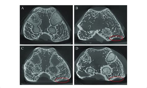 Micro Ct Results Of Articular Cartilage And Subchondral Bone After
