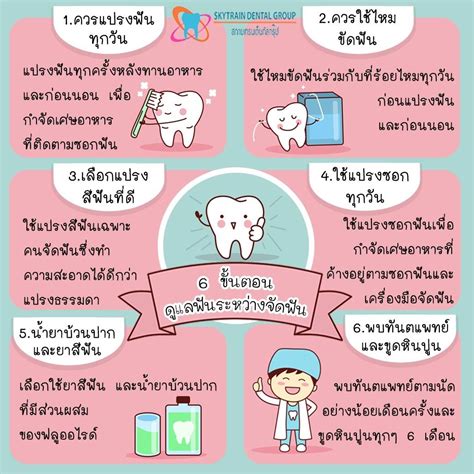 6 ขั้นตอนดูแลฟันระหว่างการจัดฟัน Siamstationdentalclinic
