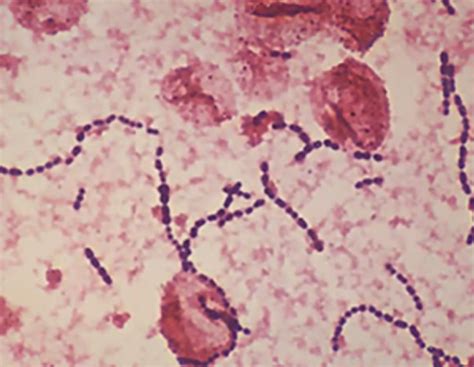 Streptococci Flashcards Quizlet