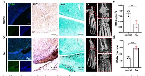 Figure 1 From Regulation Of Rheumatoid Arthritis Microenvironment Via A Self Healing Injectable