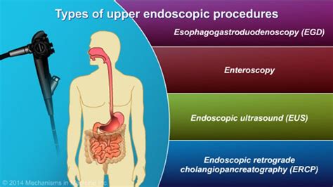 Understanding Ercp Artofit