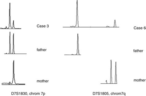 Examples Of Short Tandem Repeat Polymorphism Strp Analysis With Download Scientific Diagram