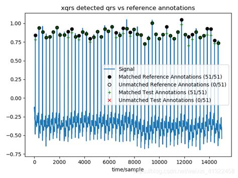 Wfdb使用说明 Csdn博客