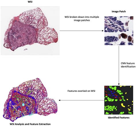 Artificial Intelligence In Pathology An Overview Diagnostic