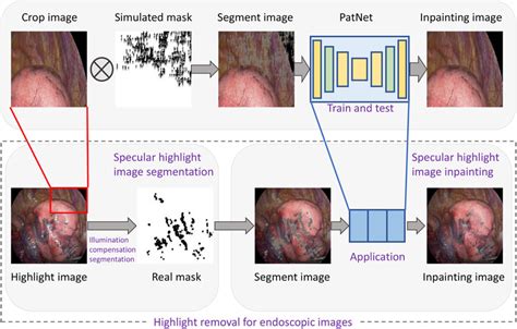 Diagram Of Processing Steps Of Specular Highlight Removal Method In Download Scientific Diagram