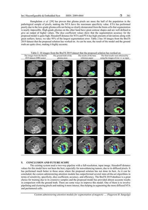 Custom Administering Attention Module For Segmentation Of Magnetic Resonance Imaging Of The