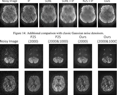figure 1 from ddm2 self supervised diffusion mri denoising with