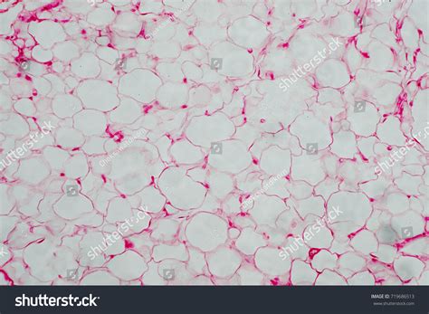 82 Imagens De Structure Of A Lipid Under The Microscope Imagens Fotos