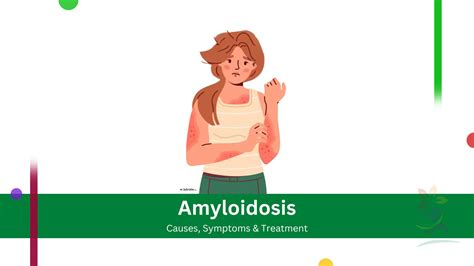 Amyloidosis Its Causes Symptoms And Treatment Guide