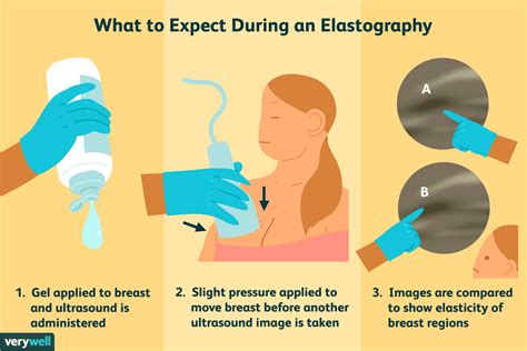 Wat Is Een Elastogram Med Nl