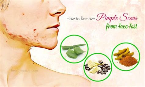 10 Tips How To Remove Pimple Scars On Nose Chest Back Legs Fast