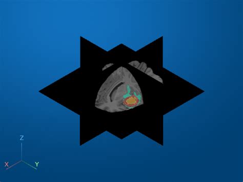 Label Volume Display Using Point And Line Annotations Matlab And Simulink
