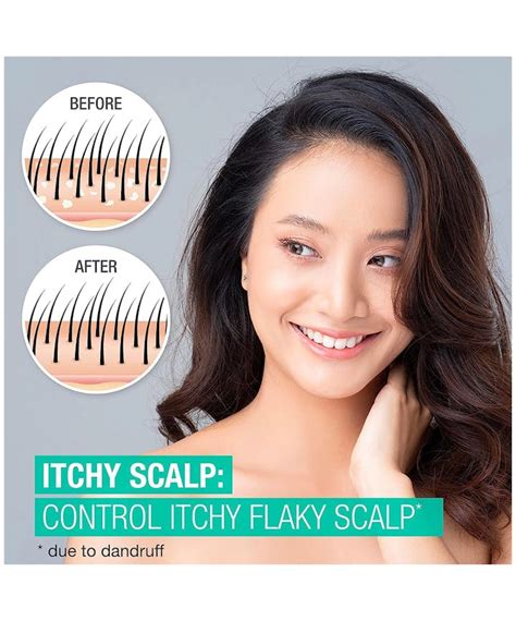 Scalp Therapy Anti Dandruff Itchy Scalp Neutrogena®