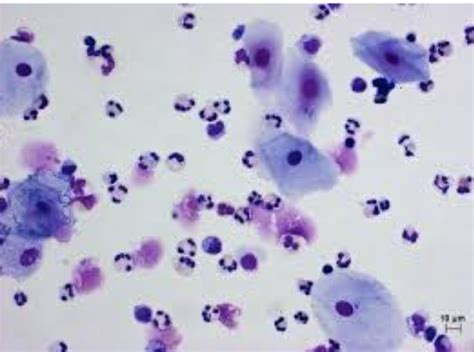 Immunology Lecture 9 Inflammation Flashcards Quizlet