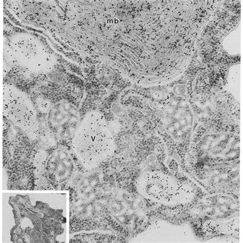 Immunohistochemical Localization Of Discoidin I In Differentiating D Download Scientific