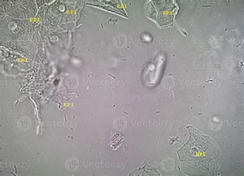 Urinalysis Microscopic At Beverly Henson Blog