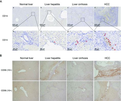 Figure S8 Ihc Sections Of Liver Tissues A Representative Image Of