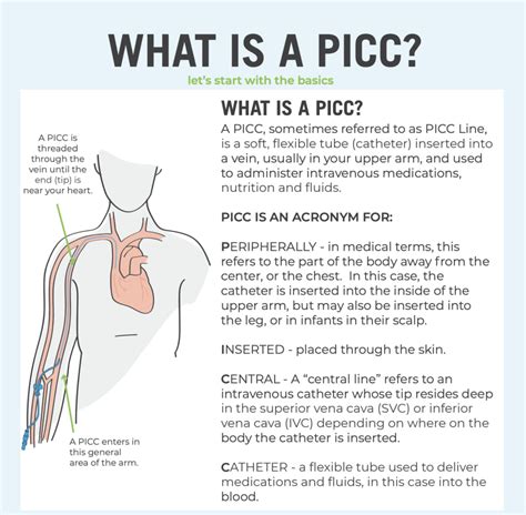 Get The Ultimate Guide To Piccs Here