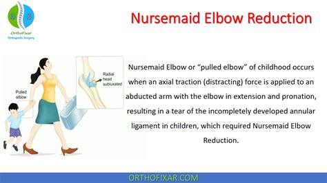 Nursemaid Elbow Reduction Easily Step By Step Orthofixar