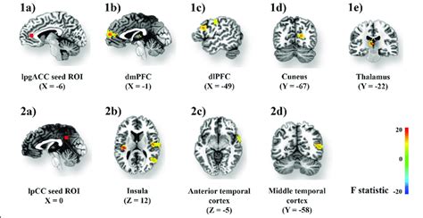 Sex Is Associated With The Ifc Of The Dmn Default Mode Network The