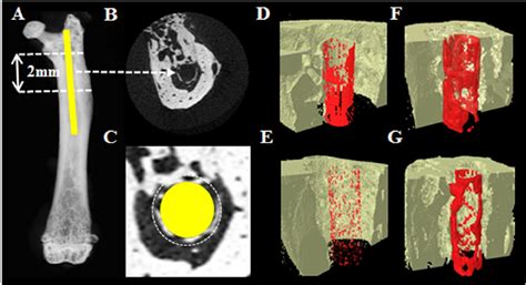 Qualitative Micro Ct Analysis Of Fgf18 Stimulated Peri Implant Bone