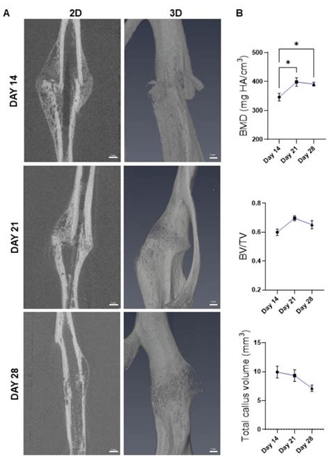 Assessment Of Bone Fracture Healing Using Micro Computed Tomography