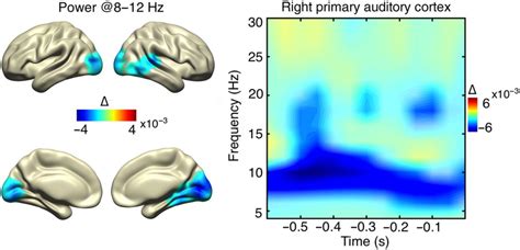 Prestimulus Source Power Modulations The Spatial Distribution Of